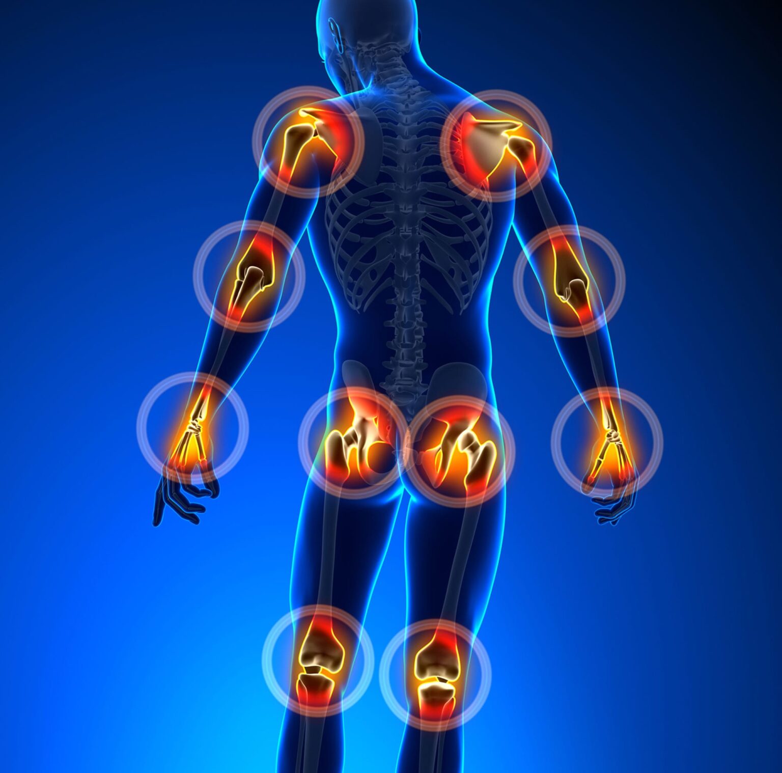 Best 11 Supplements To Repair Cartilage, Ligaments & Tendons - Living ...